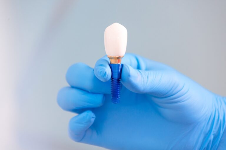 What Is a Temporary Solution While Waiting for Implants?